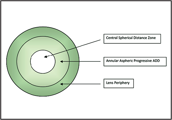 Contact Lens Spectrum | PentaVision