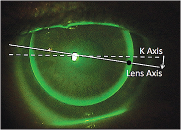 Contact Lens Spectrum | PentaVision