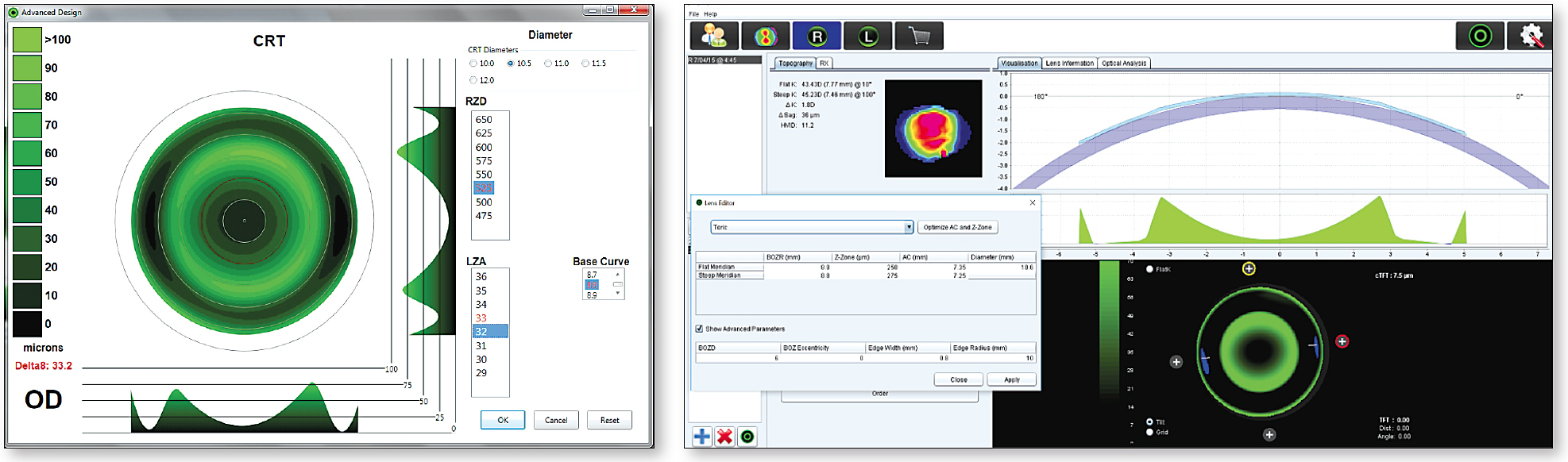 Contact Lens Spectrum | PentaVision