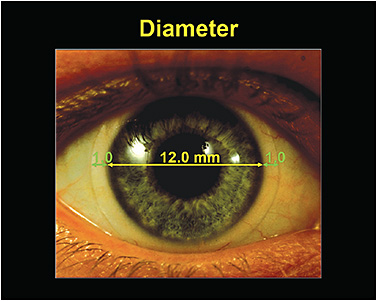 Contact Lens Spectrum | PentaVision