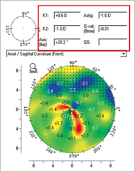 Contact Lens Spectrum | PentaVision