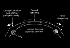 Contact Lens Spectrum | PentaVision