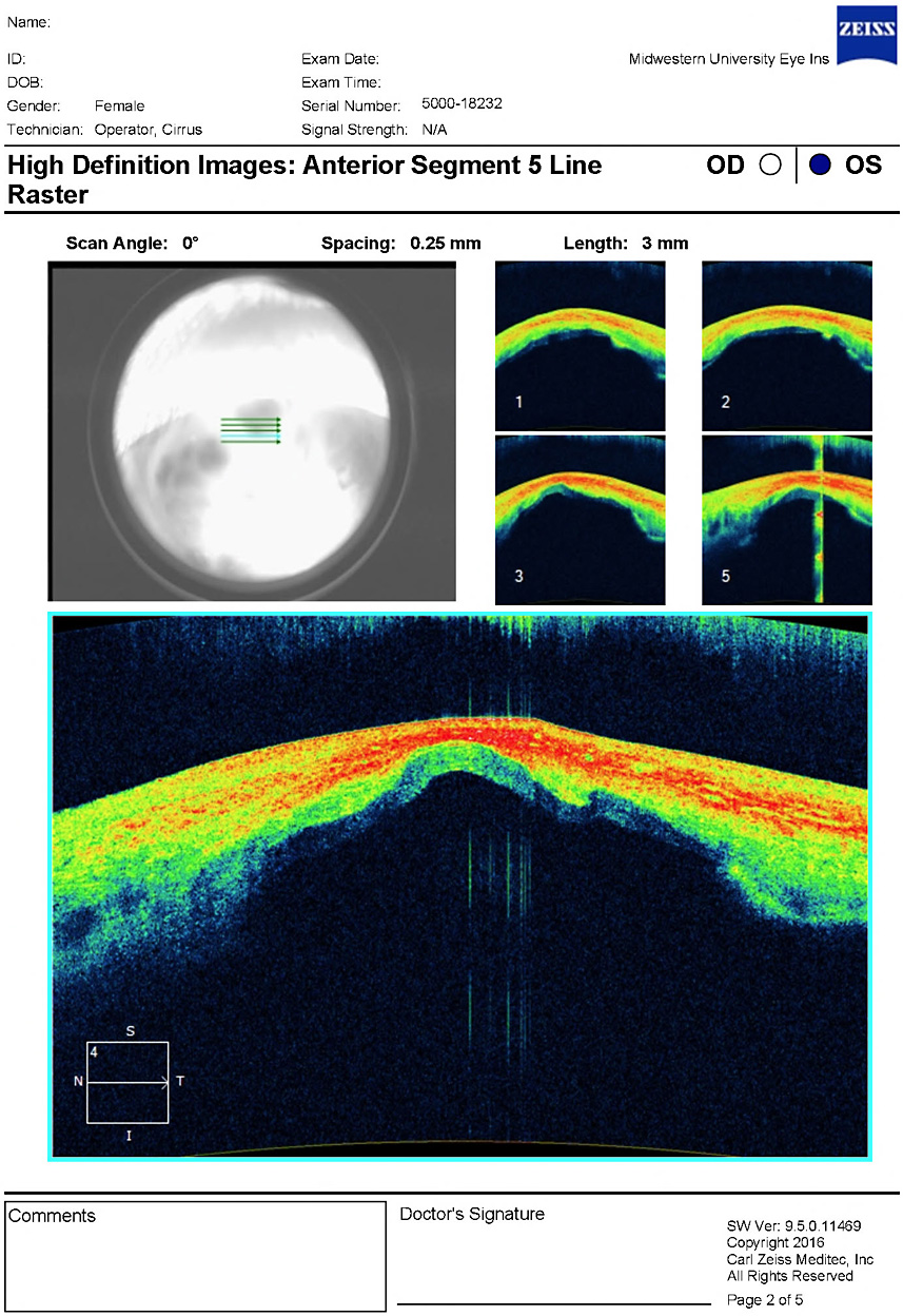 Contact Lens Spectrum | PentaVision