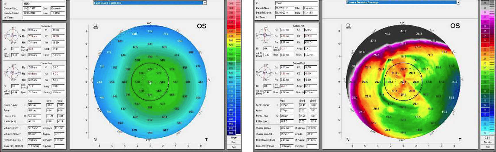Contact Lens Spectrum | PentaVision
