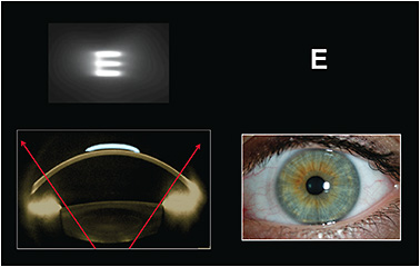 Contact Lens Spectrum | PentaVision