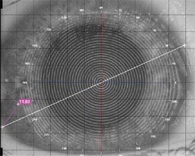 Contact Lens Spectrum | PentaVision