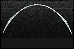 Contact Lens Spectrum | PentaVision