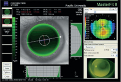 Contact Lens Spectrum | PentaVision