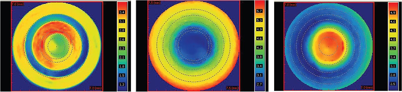 Contact Lens Spectrum | PentaVision