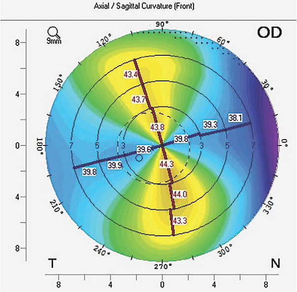 Contact Lens Spectrum | PentaVision