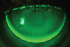 Contact Lens Spectrum | PentaVision