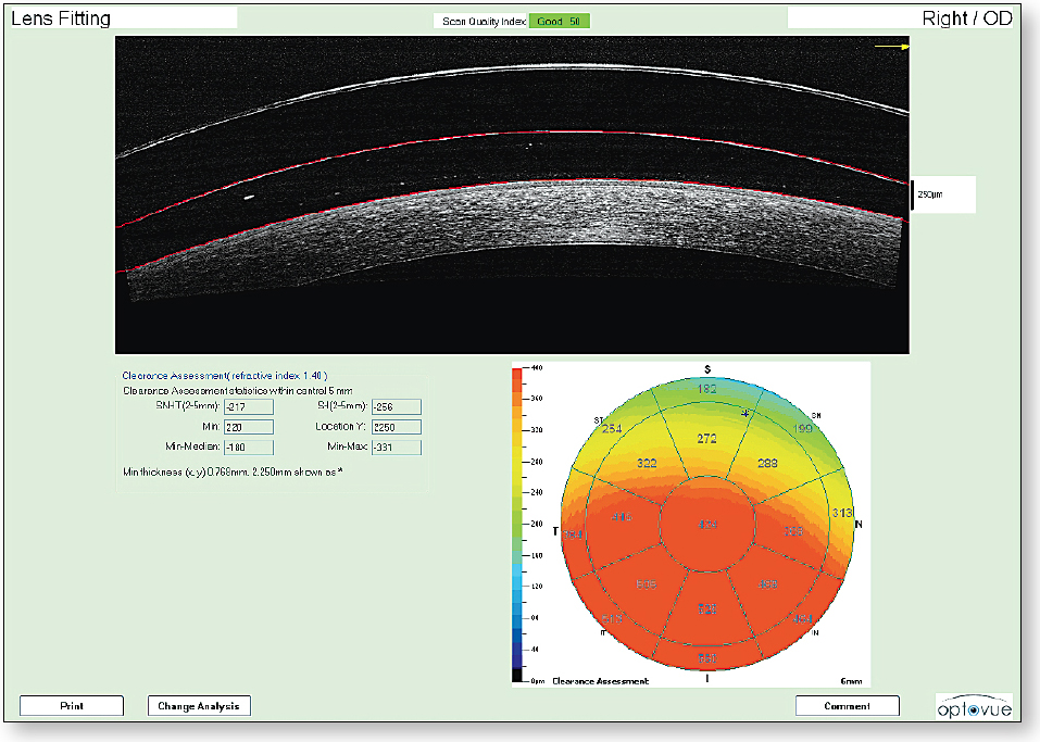 Contact Lens Spectrum | PentaVision