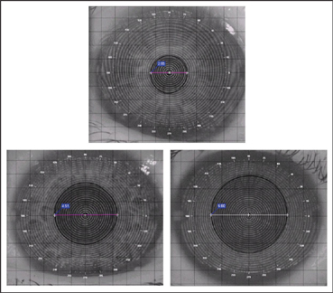 Contact Lens Spectrum | PentaVision