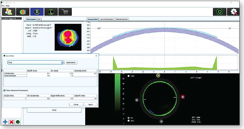 Contact Lens Spectrum | PentaVision