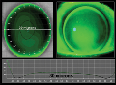 Contact Lens Spectrum | PentaVision