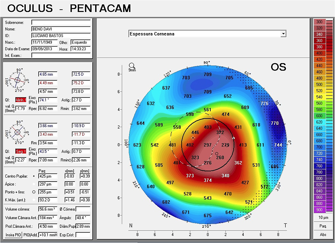 Contact Lens Spectrum | PentaVision