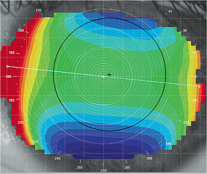 Contact Lens Spectrum | PentaVision