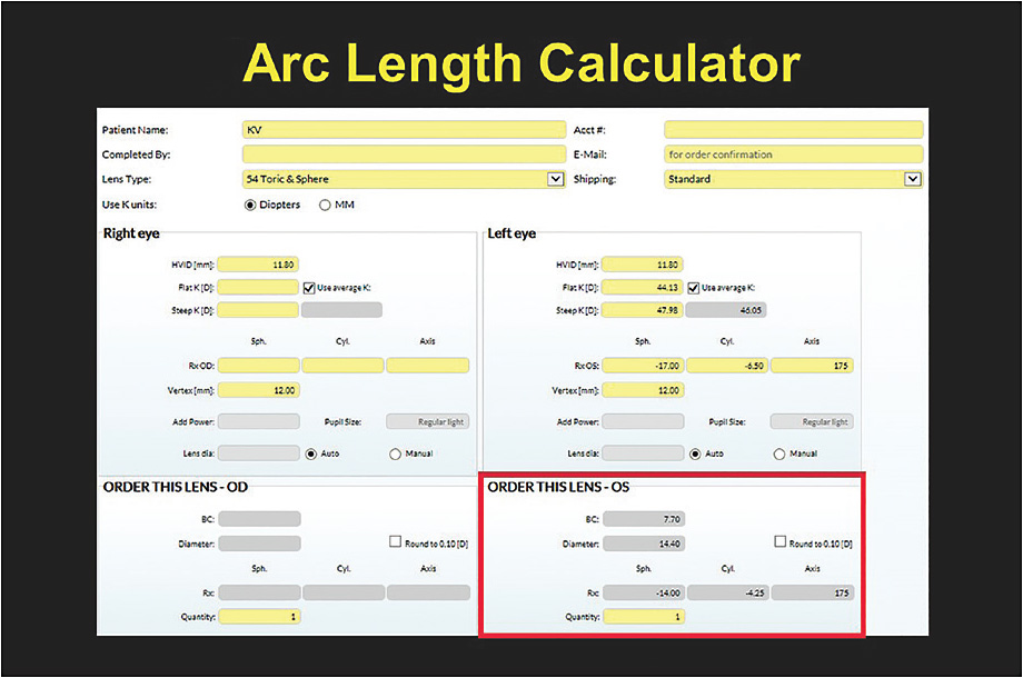 Contact Lens Spectrum | PentaVision