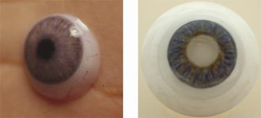 Contact Lens Spectrum | PentaVision
