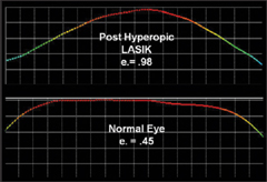 Contact Lens Spectrum | PentaVision