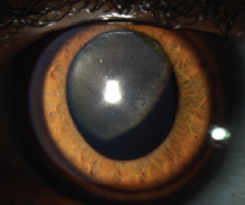 Contact Lens Spectrum | PentaVision