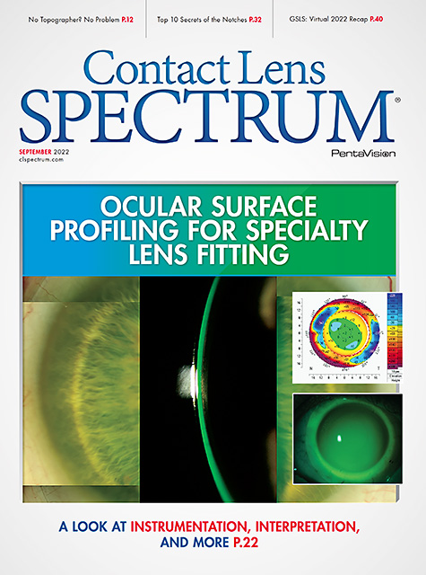 September | Contact Lens Spectrum