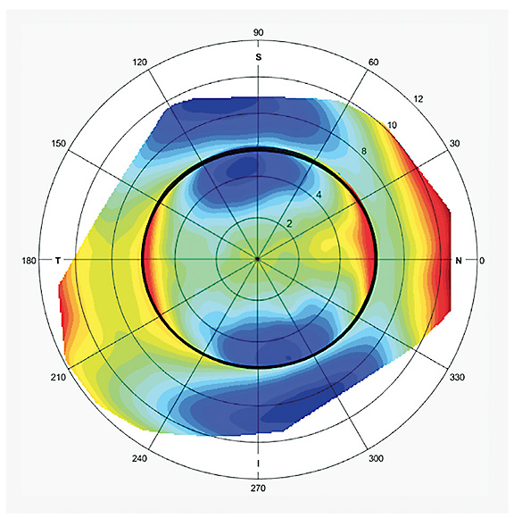 Contact Lens Spectrum | PentaVision