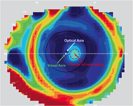 Contact Lens Spectrum | PentaVision