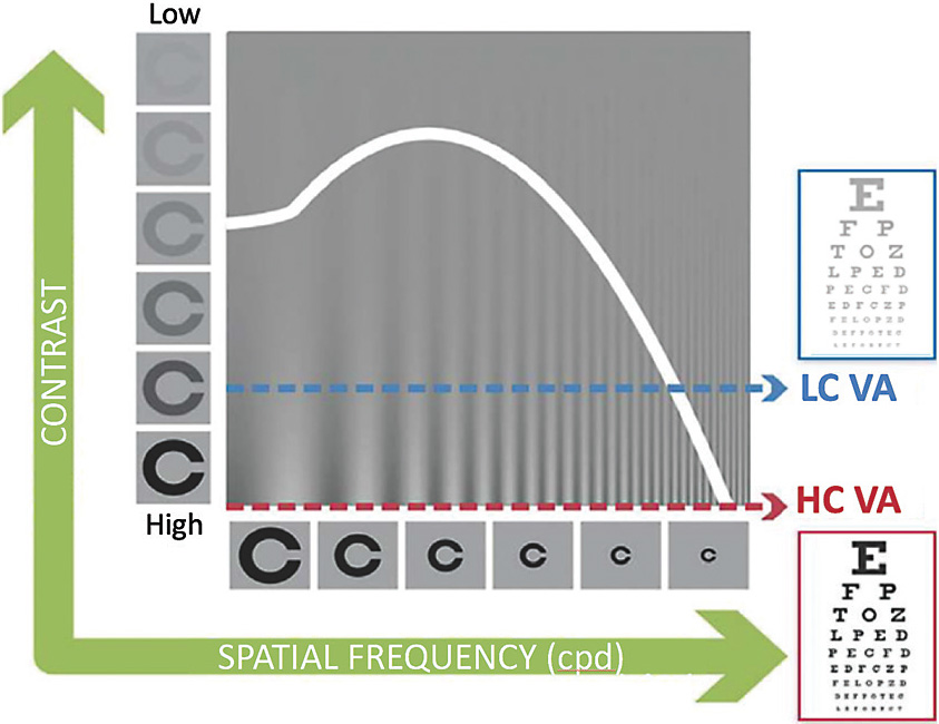 Contact Lens Spectrum | PentaVision