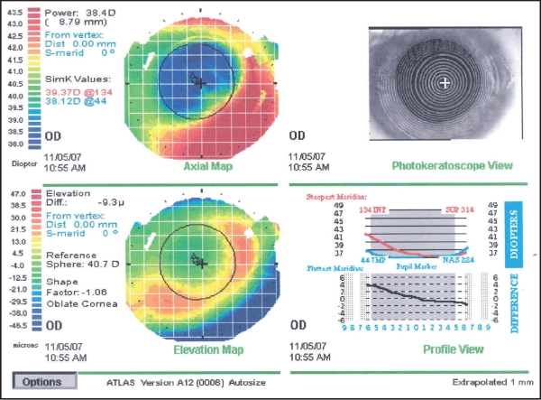 Contact Lens Spectrum | PentaVision