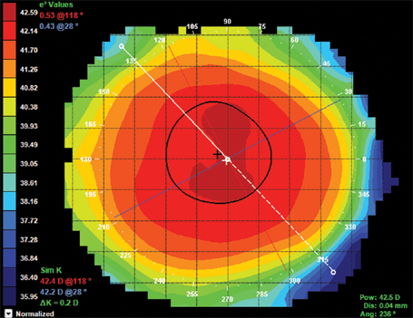 Contact Lens Spectrum | PentaVision