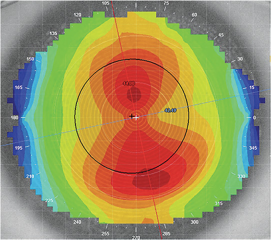 Contact Lens Spectrum | PentaVision