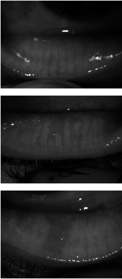 Contact Lens Spectrum | PentaVision