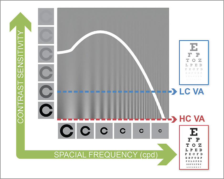 Contact Lens Spectrum | PentaVision