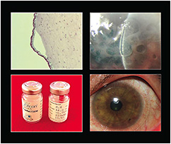 Contact Lens Spectrum | PentaVision