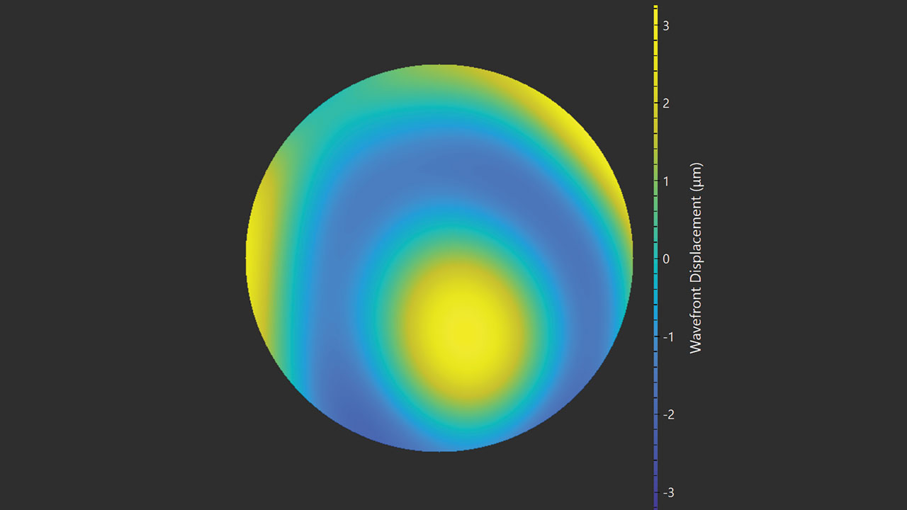 Contact Lens Case Report: Scleral Lenses With Wavefront Optics ...
