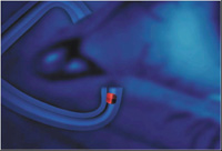 Contact Lens Spectrum | PentaVision