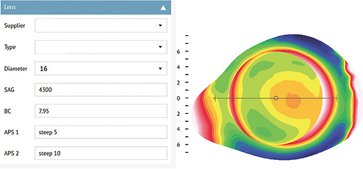 Contact Lens Spectrum | PentaVision