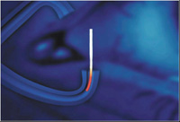 Contact Lens Spectrum | PentaVision