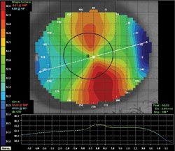 Contact Lens Spectrum | PentaVision