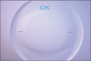 Contact Lens Spectrum | PentaVision