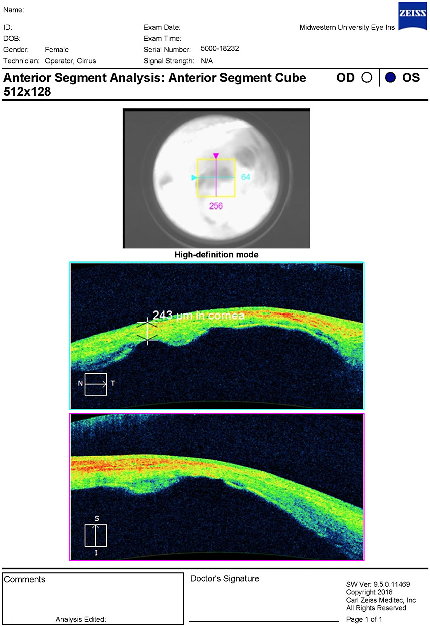Contact Lens Spectrum | PentaVision