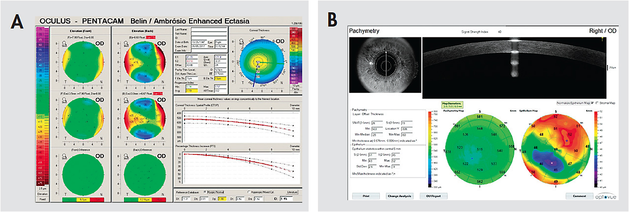 Contact Lens Spectrum | PentaVision