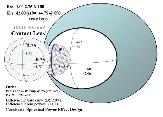 Contact Lens Spectrum | PentaVision