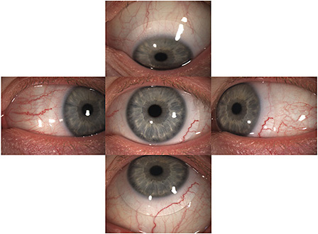 Contact Lens Spectrum | PentaVision
