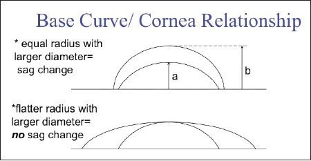 Contact Lens Spectrum | PentaVision