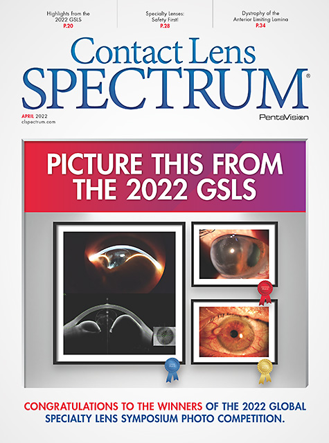 2022 | Contact Lens Spectrum