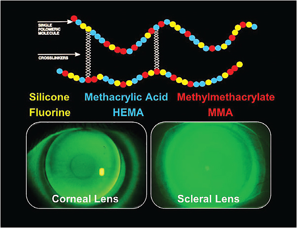 Contact Lens Spectrum | PentaVision