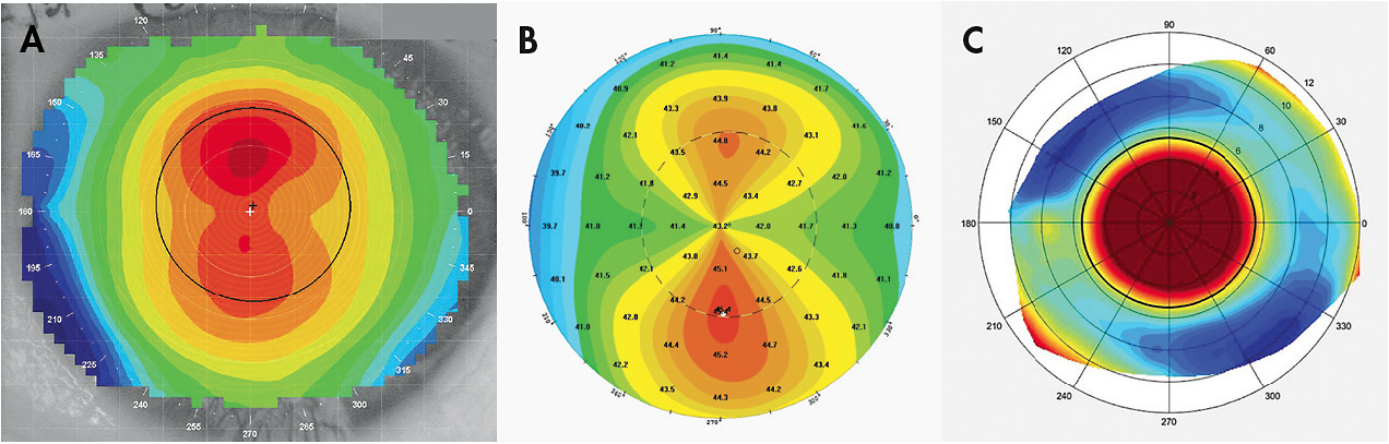 Contact Lens Spectrum | PentaVision