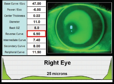 Contact Lens Spectrum | PentaVision